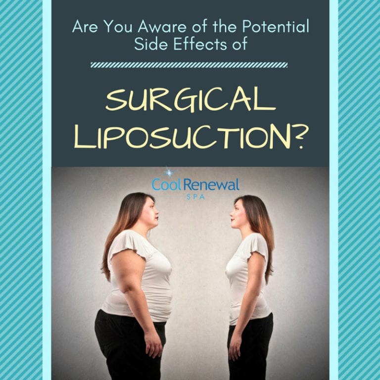 Are You Aware of the Potential Side Effects of Surgical Liposuction ...
